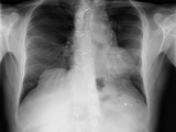 Github N0obcoder Nih Chest X Rays Multi Label Image Classification In